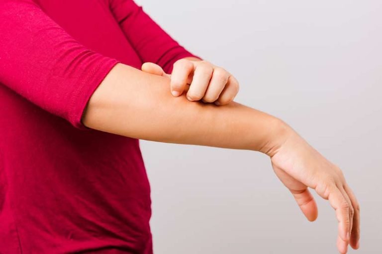 7 Causes of Itchy Skin You May Not Have Known About
